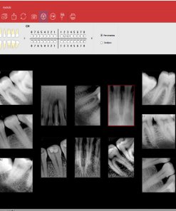 Sensor Radiológico Digital odontológico TIMEX 2H - Gnatus