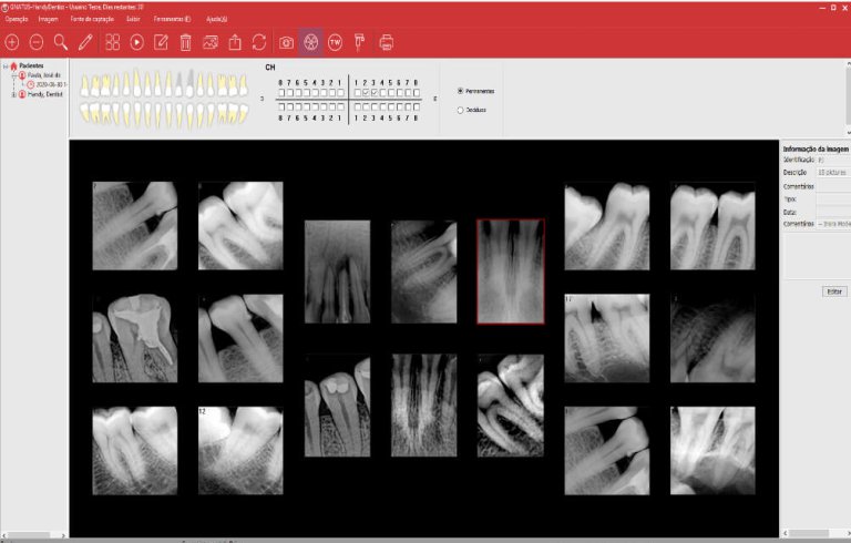 Sensor Radiológico Digital odontológico TIMEX 2H - Gnatus