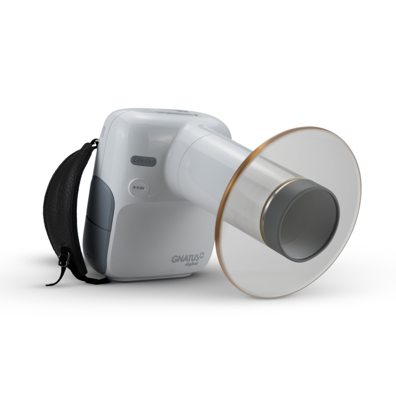 Raio-X Portátil Timex | Compre em 10x s/juros - Gnatus